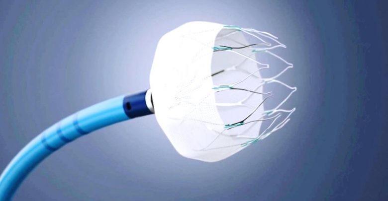 Transcatheter Embolization and Occlusion Devices Find Application in ...