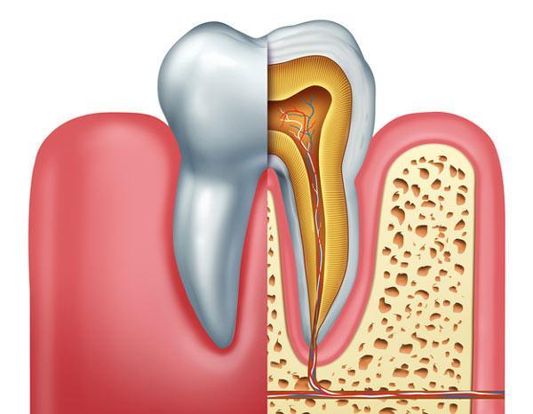 Carmel IN Root Canal Treatment For Infected Teeth Dental Procedures ...