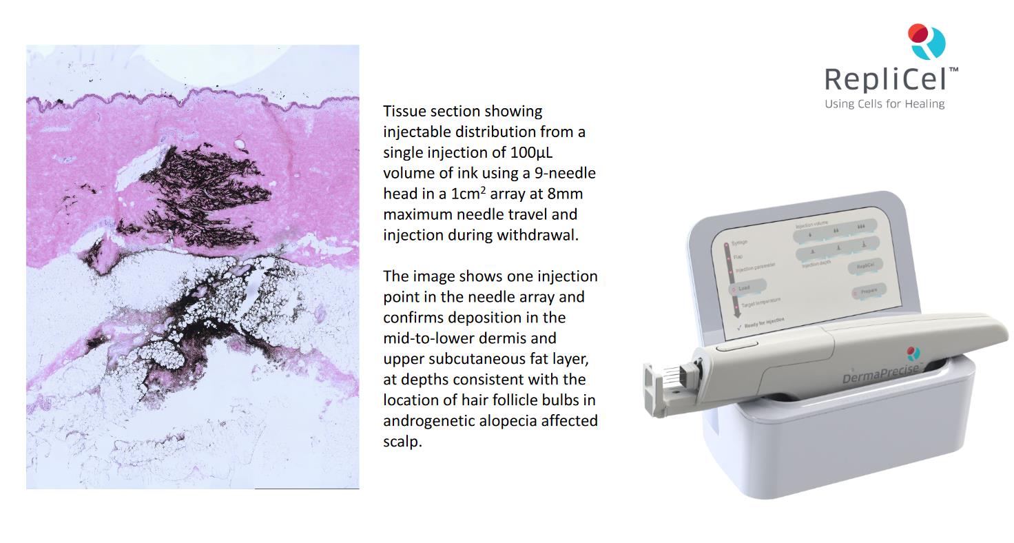 Dermaprecise(TM) Injection System Shown To Produce Consistently High ...