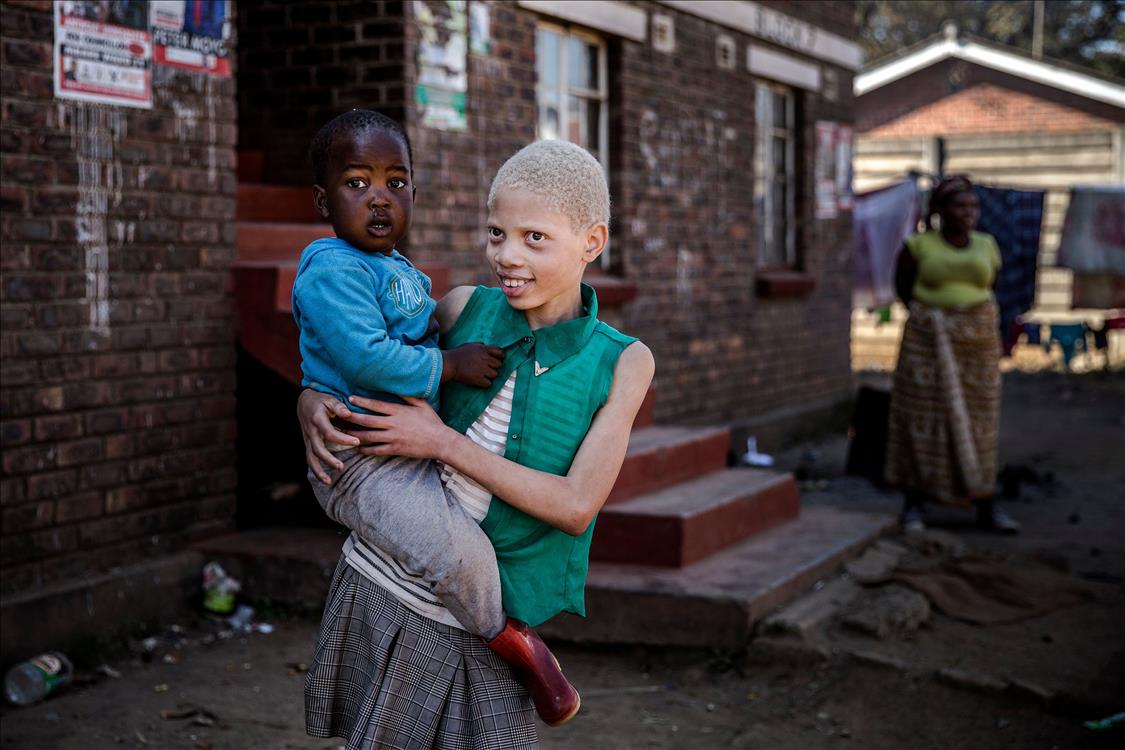Being Light-Skinned Can Lead To 'Reverse Colorism' In Many Parts Of The ...