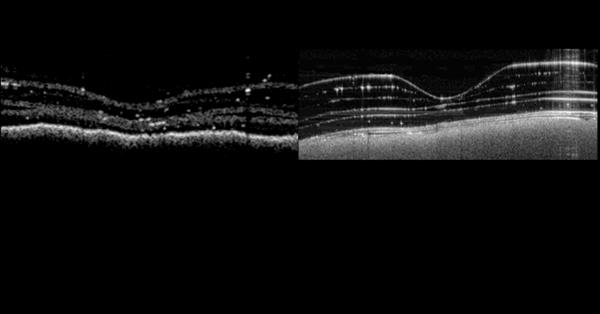 Siloton Obtains Ground-Breaking Optical Coherence Tomography Image With ...
