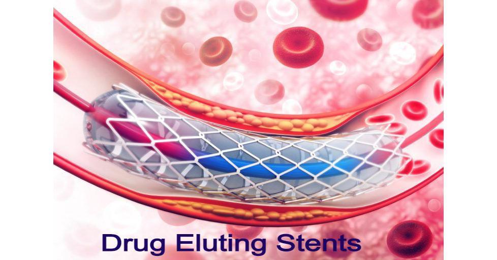 Drug Eluting Stents Market See Incredible Growth 2023-2030:Biotronik ...