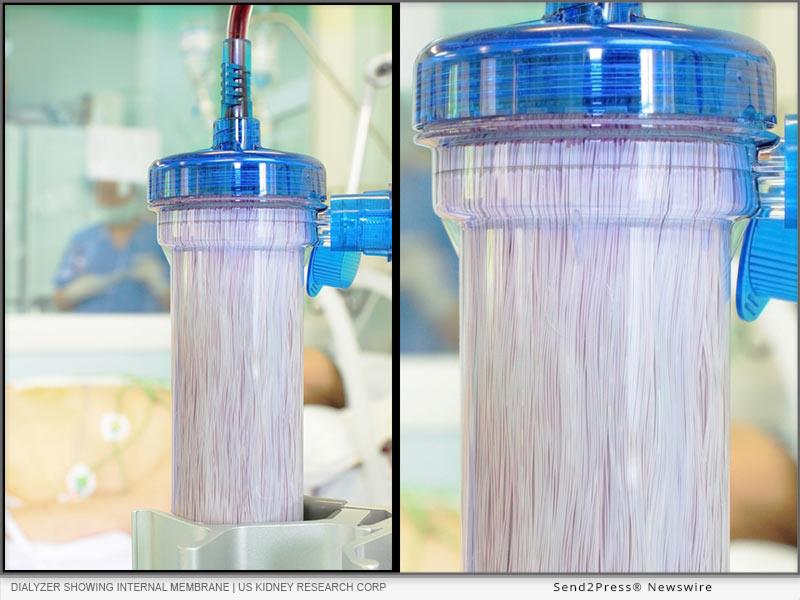 Us Kidney Research Corp Unveils Breakthrough Ultrafilter Membrane For ...