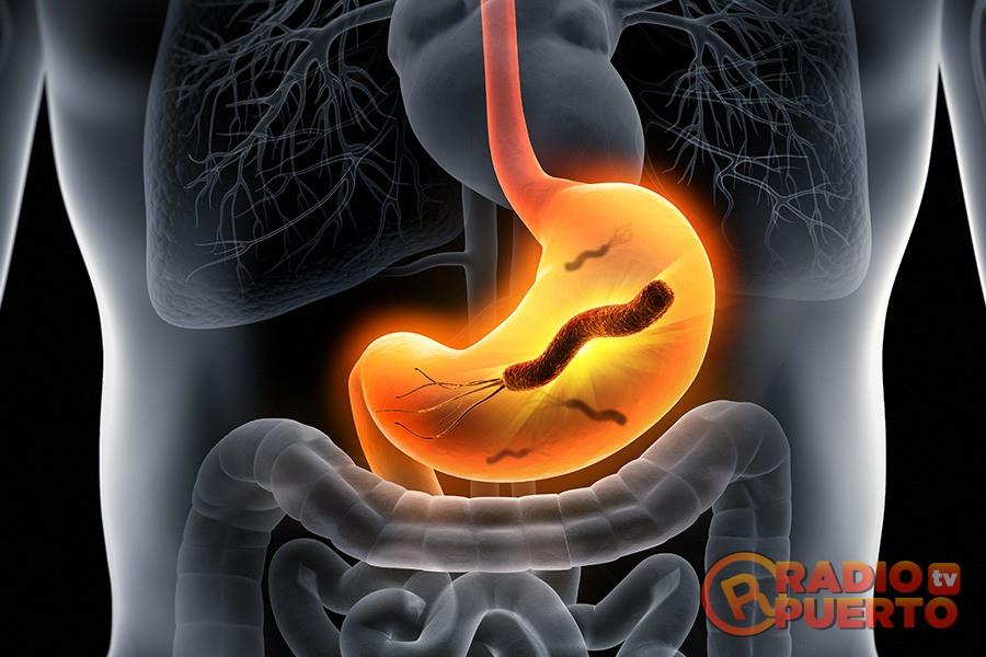 Seven Out Of Ten Costa Ricans Suffer From The Bacteria Helicobacter Pylori