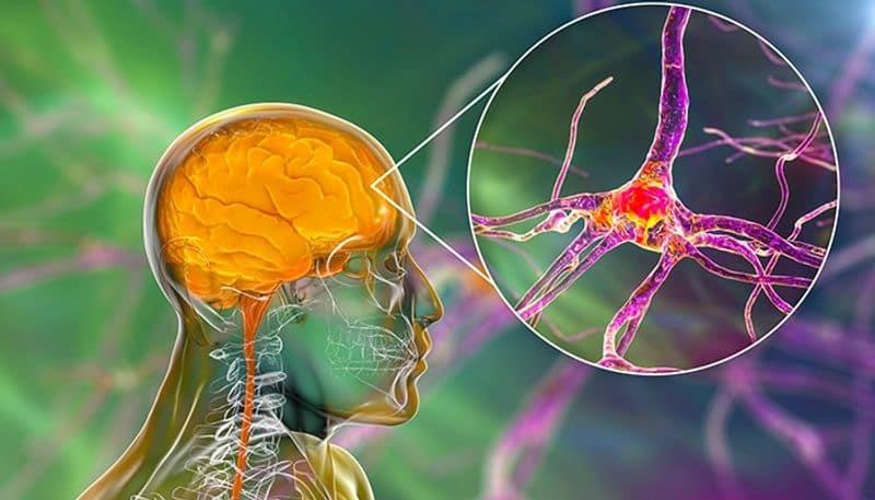 What Is Trigeminal Neuralgia? Know Its Symptoms, Causes, Diagnosis ...