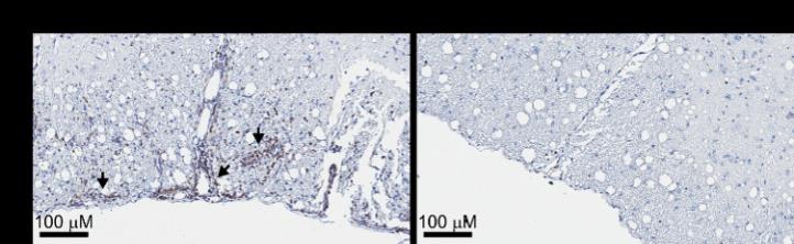 Trethera Receives $2M NIH Grant For Preclinical Development In The ...