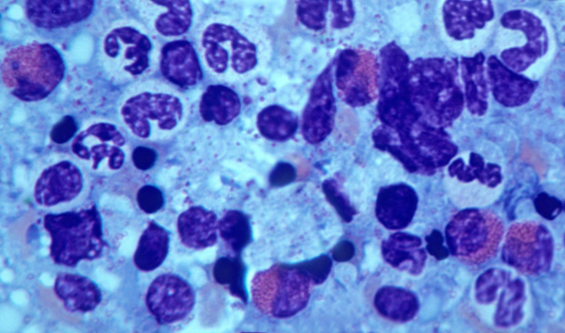 Biobots Pushing Boundaries Of Life, Death And Medicine