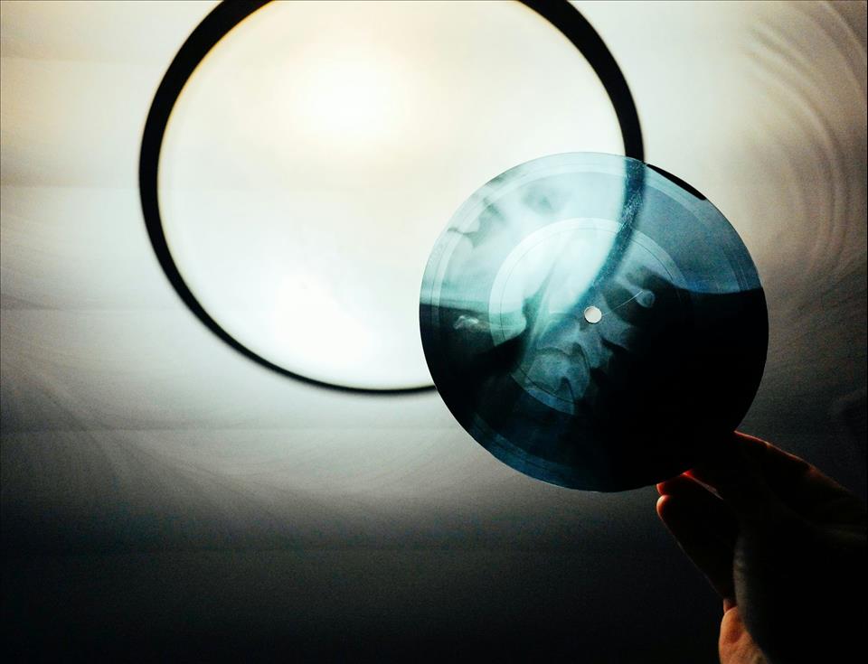 When Elvis And Ella Were Pressed Onto X-Rays The Subversive Legacy Of ...